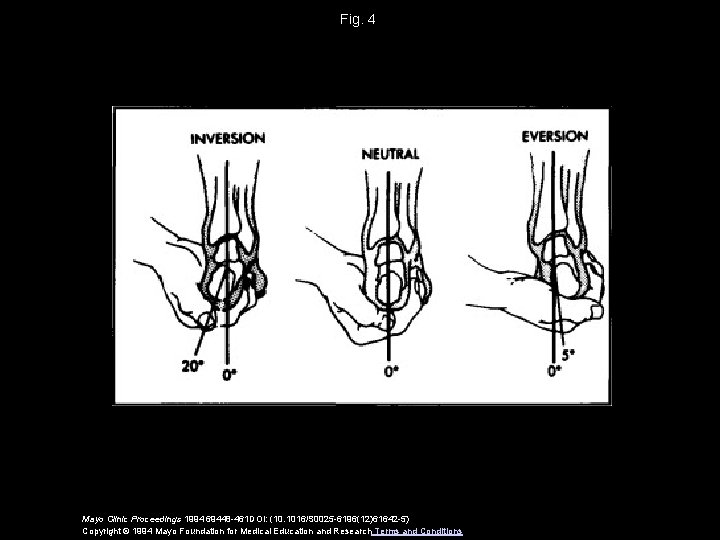 Foot Biomechanics During Walking and Running CARL W