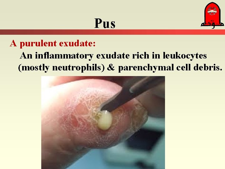 Pathophysiology L 4 Inflammation Prof Fakhir AlAni fakeralani