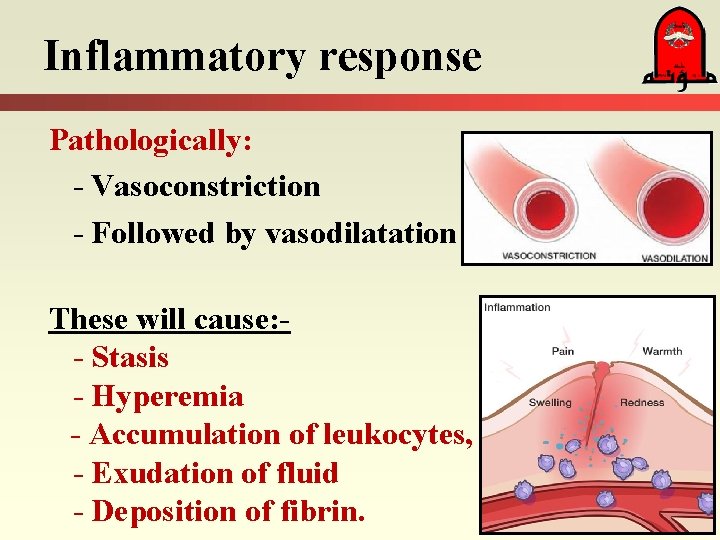Pathophysiology L 4 Inflammation Prof Fakhir AlAni fakeralani