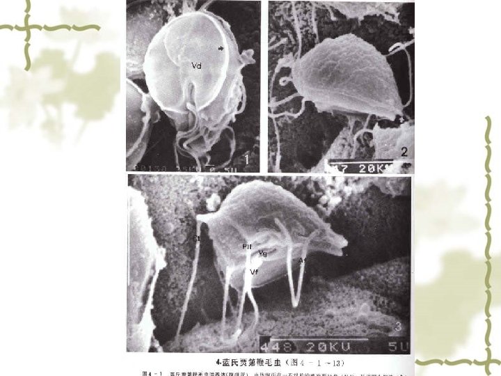 Giardia lamblia Intestinal flagellate Giardia lambilia lives in