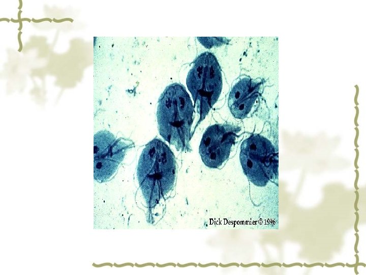 Giardia lamblia Intestinal flagellate Giardia lambilia lives in