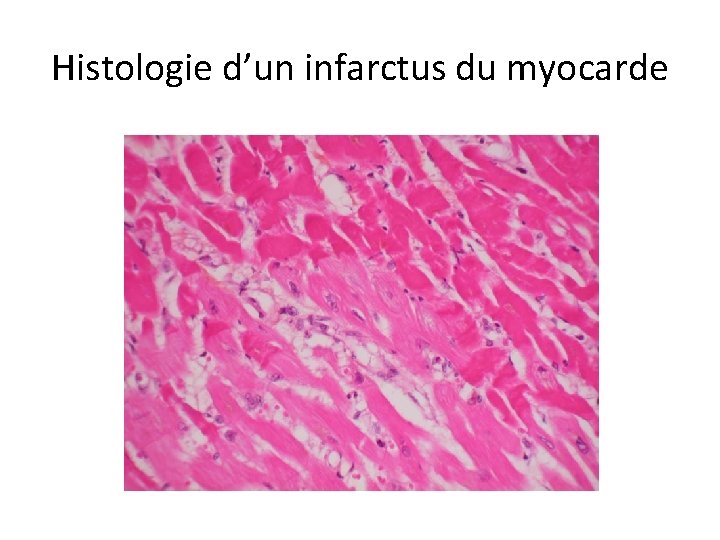 Les troubles de la circulation 2 Cours danatomie