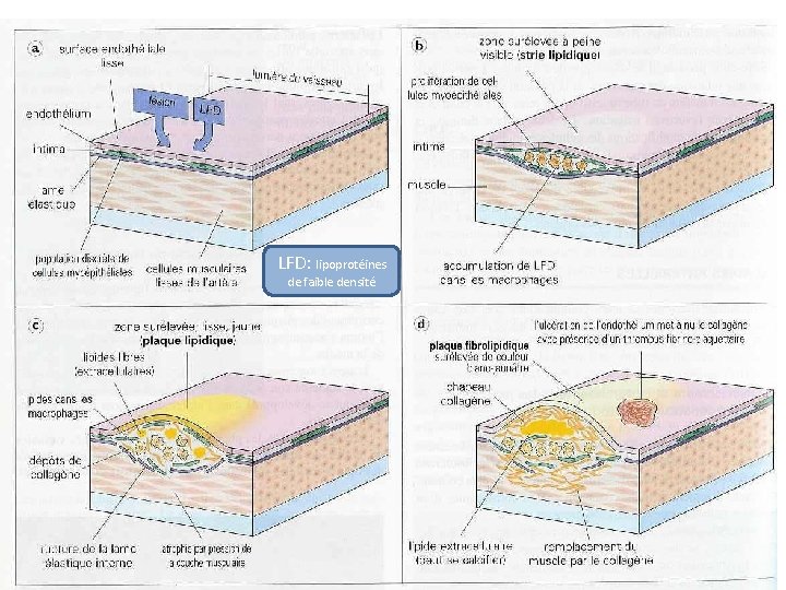 Les troubles de la circulation 2 Cours danatomie
