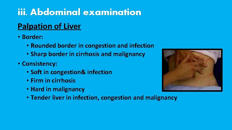 HEPATOSPLE NOMEGALY PBL 22 SUPERVISED BY DR WALAA