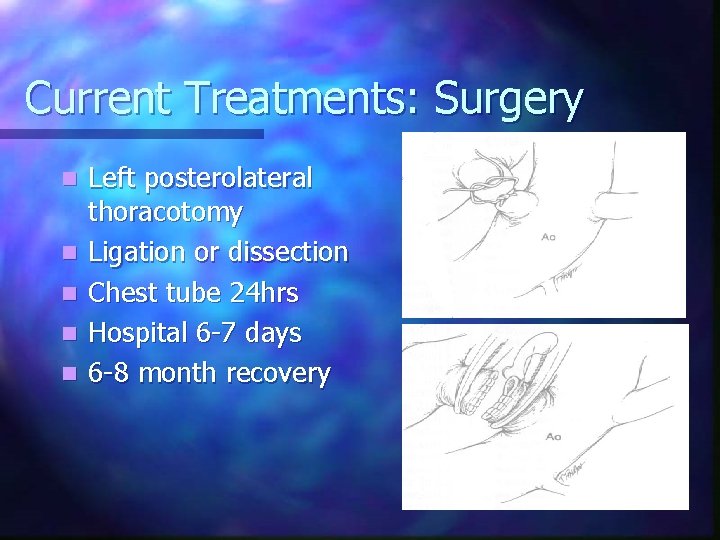 Patent Ductus Arteriosus Occlusion Device Christina Mathieson Trung
