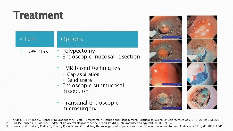 Review on Rectal Carcinoid Joint Hospital Surgical Grand
