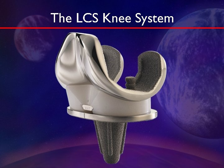 1998 Global Hip Market Share Global 1 949