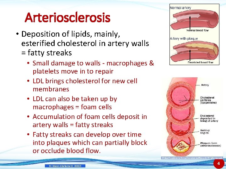 Lipids Lipoproteins Part 2 Lecture 13 Dr Mazen