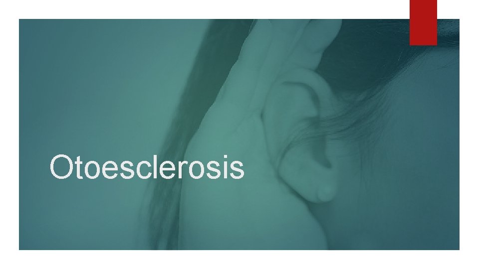 Otoesclerosis Otoesclerosis Es una de las principales causas