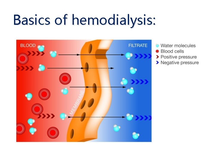 Spotlight on general principles of hemodialysis Mohammed Wahba