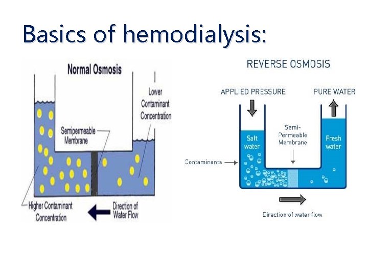 Spotlight on general principles of hemodialysis Mohammed Wahba