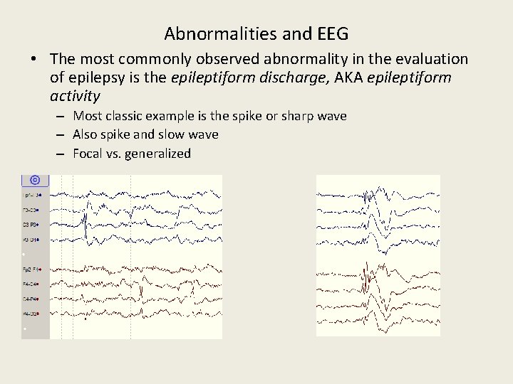 The Role of EEG in the Diagnosis and