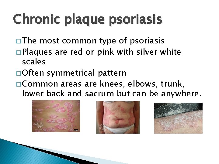 Dermatology for Phototherapists Skin conditions that can be