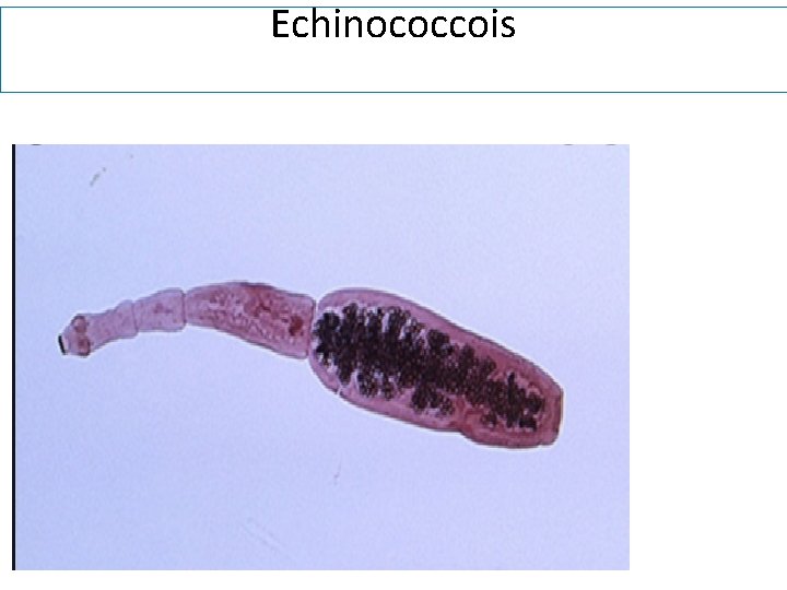 Echinococcois Echinococcois Human echinococcosis is a zoonotic disease