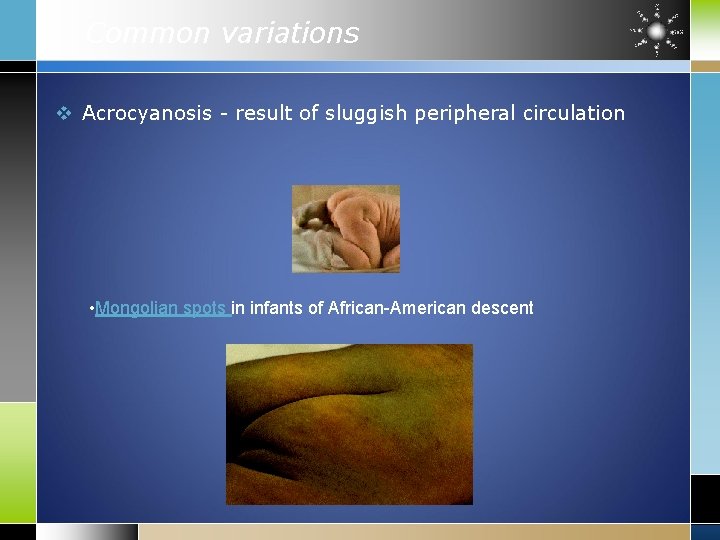 New Born Vital Signs Designed By Dr Areefa