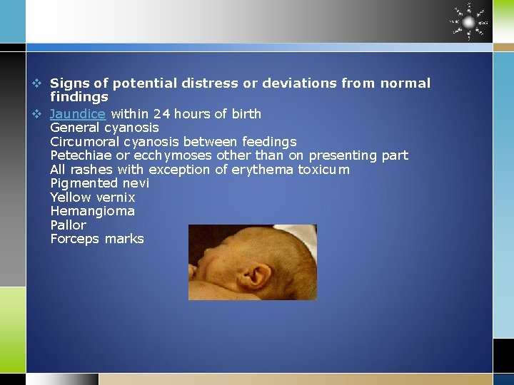 New Born Vital Signs Designed By Dr Areefa
