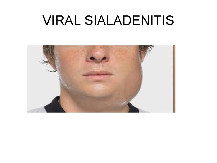 LECTURE 2 SALIVARY GLANDS Fatima Obeidat MD SALIVARY