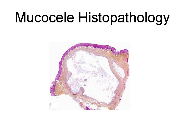 LECTURE 2 SALIVARY GLANDS Fatima Obeidat MD SALIVARY