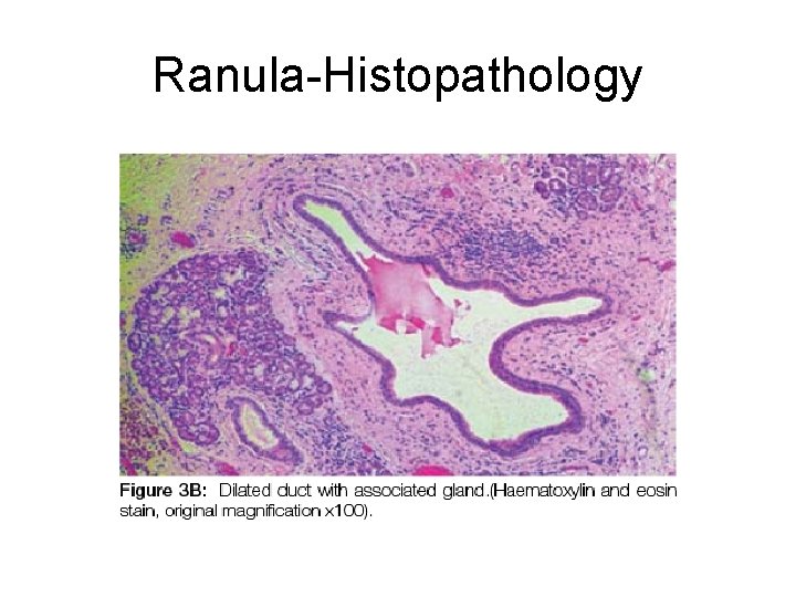 LECTURE 2 SALIVARY GLANDS Fatima Obeidat MD SALIVARY