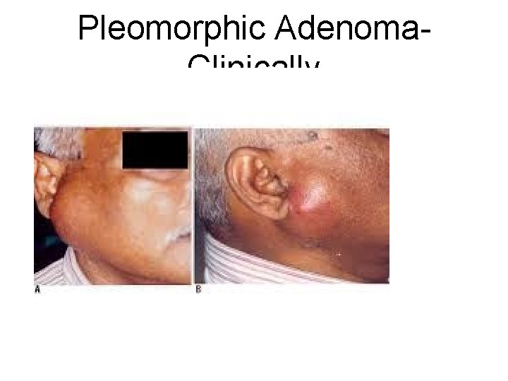 LECTURE 2 SALIVARY GLANDS Fatima Obeidat MD SALIVARY