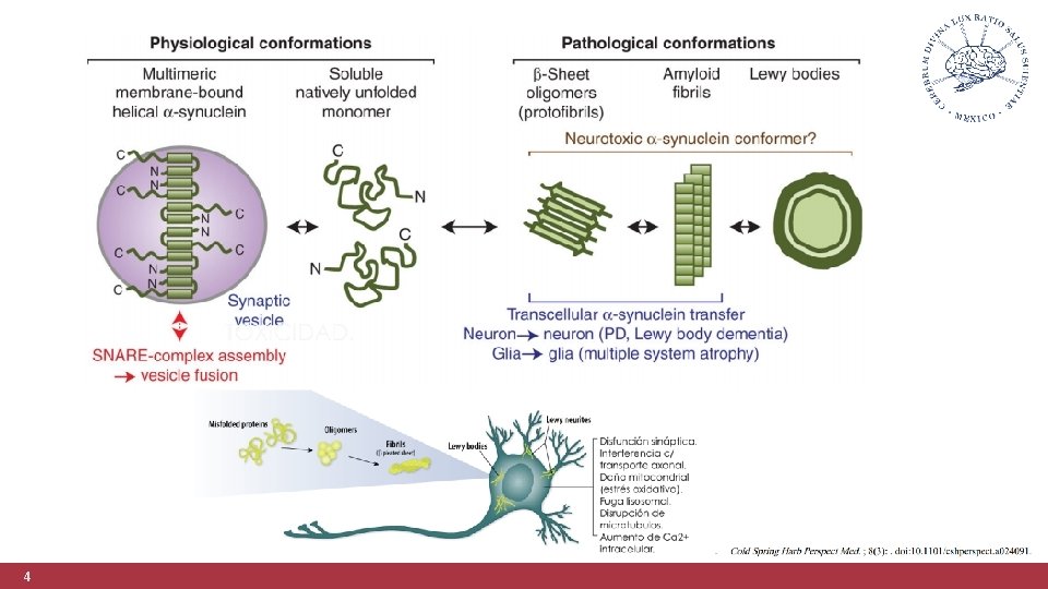 Alfasinuclena Y Neuroinflamacin En La Enfermedad De Parkinson