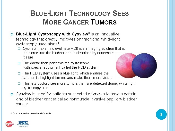 BLADDER CANCER WHAT YOU NEED TO KNOW Sponsored