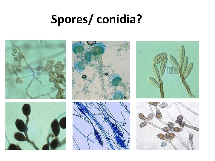 Lecture Title Fungi and their pathogenesis Foundation Block