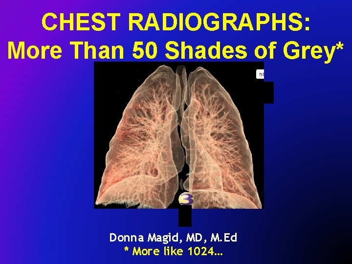 Good Morning CHEST RADIOGRAPHS More Than 50 Shades
