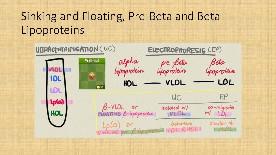 Lipoprotein electrophoresis Mr Ali Hana Mr Mohamed Hsen