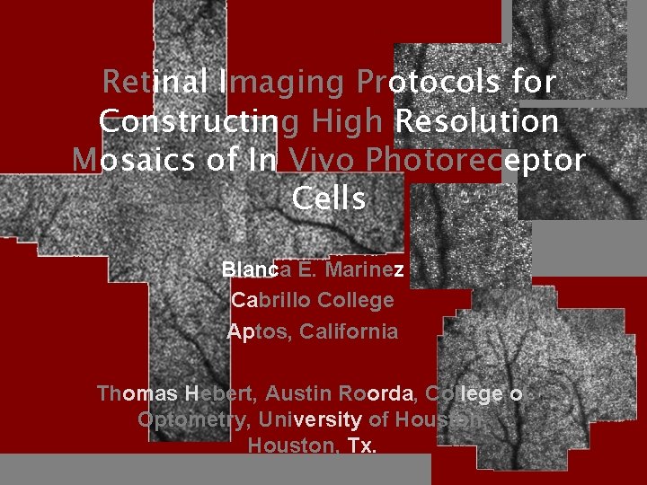 Retinal Imaging Protocols for Constructing High Resolution Mosaics