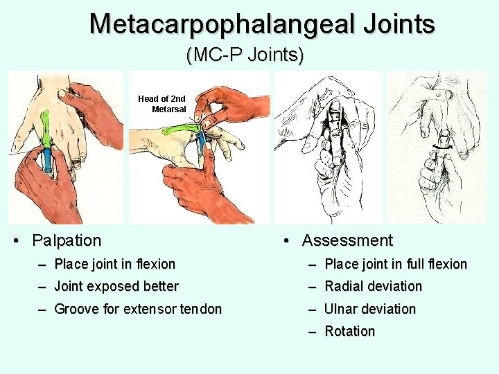 Metacarpals Palpated in order Numbered 1 5 Starting