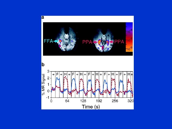 Fisiologia della coscienza della vigilanza Piergio Strata Conscience