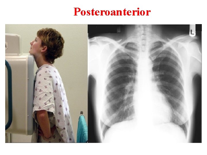 Radiological Anatomy Of The Chest Objectives By the