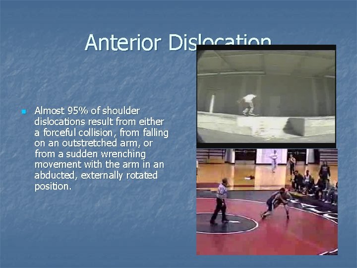 How To Manage Anterior Traumatic Instability of the