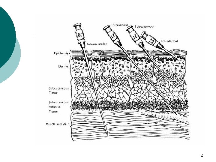 Parenteral Drug Delivery Dr Mohammad Issa 1 2