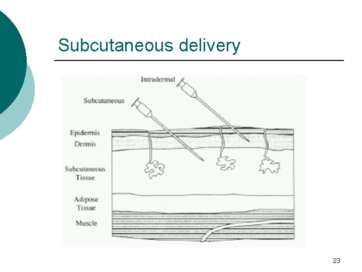Parenteral Drug Delivery Dr Mohammad Issa 1 2