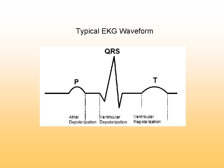 Wireless Musical Electrocardiogram Amy Tang and Sinit Vitavasiri