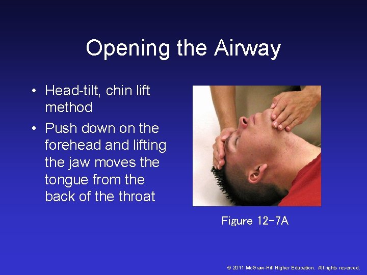 Chapter 12 OntheField Acute Care and Emergency Procedures