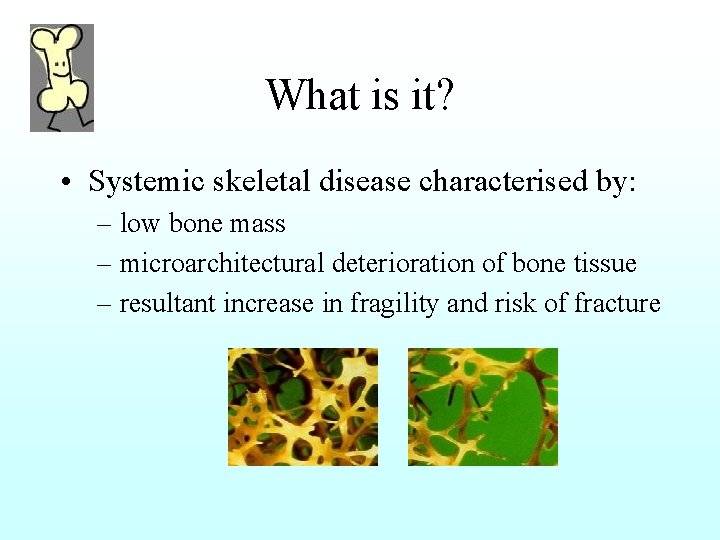 Osteoporosis What is it Systemic skeletal disease characterised
