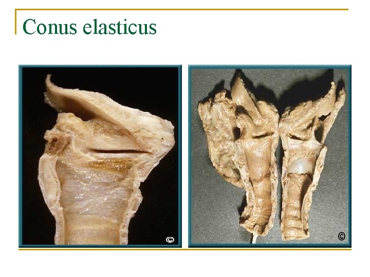 Anatomy of Larynx General principles of development n