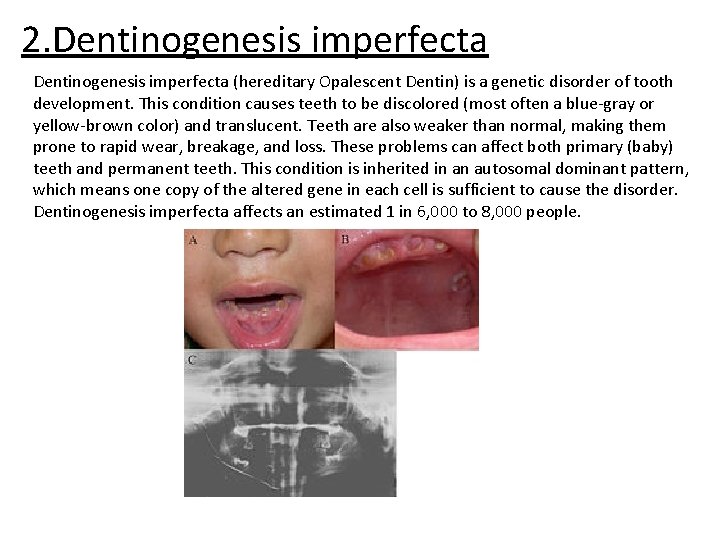 Assignment Topic Enlist five developmental disturbances of teeth