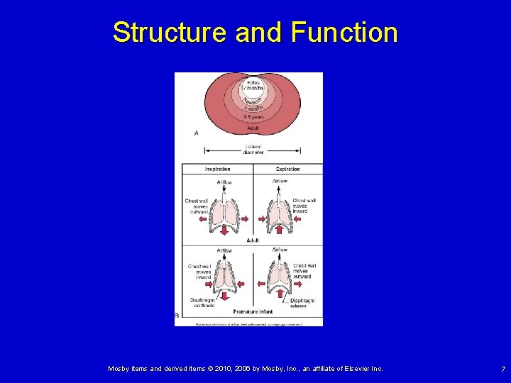 Chapter 34 Alterations of Pulmonary Function in Children
