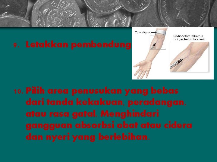 TEKNIK PEMBERIAN INJEKSI IV Pengertian Injeksi intravena adalah