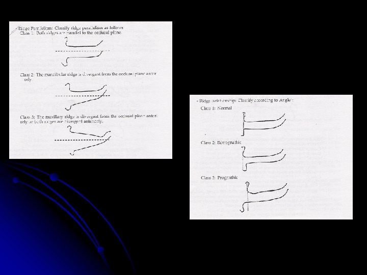 Diagnosis and Treatment Plan for Complete Denture Patients