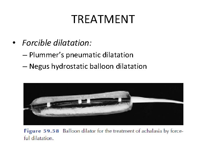 OESOPHAGEAL MOTILITY DISORDERS ACHALASIA CARDIA DEFINITION It is