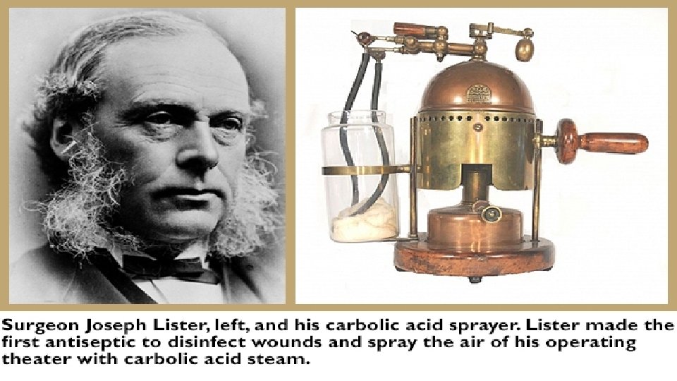 Joseph Jackson Lister The father of antiseptic surgery