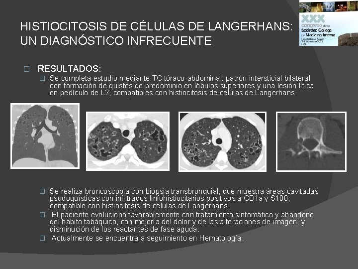 HISTIOCITOSIS DE CLULAS DE LANGERHANS UN DIAGNSTICO INFRECUENTE