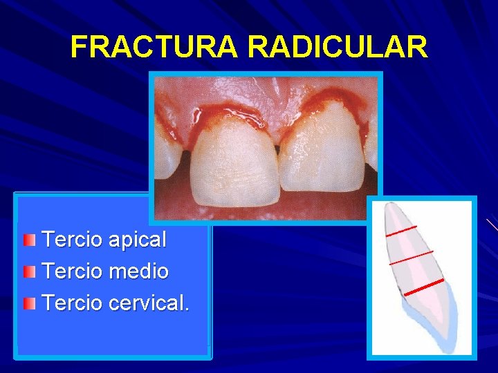 ODONTOPEDIATRA TEMA V LESIONES TRAUMTICAS EN DIENTES TEMPORALES