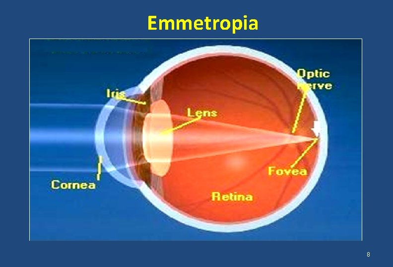 CLINICAL APPROACH TO REFRACTIVE ERRORS Ayesha Abdullah 27