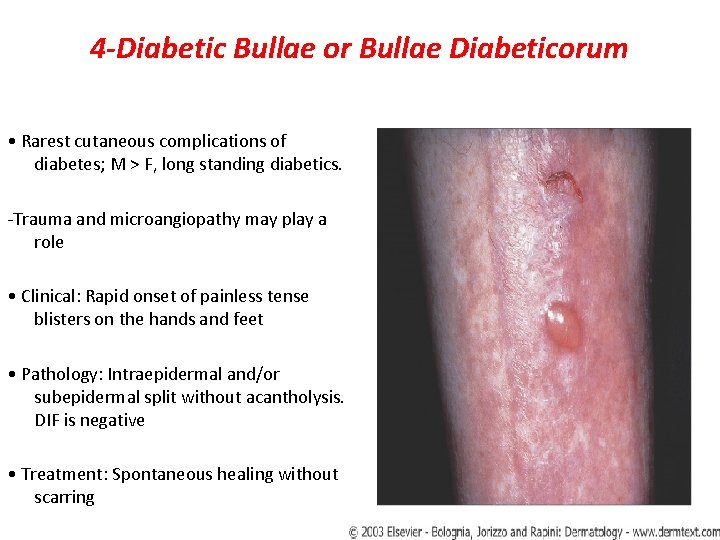 Cutaneous Manifestation of Systemic disease By Dr Eman